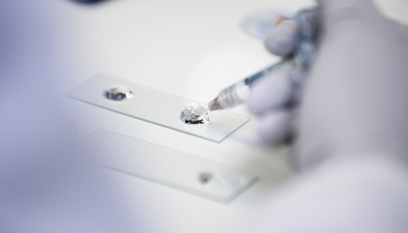 IPN-Like Technology | Hyaluronic acid-based medical device | Vivacy